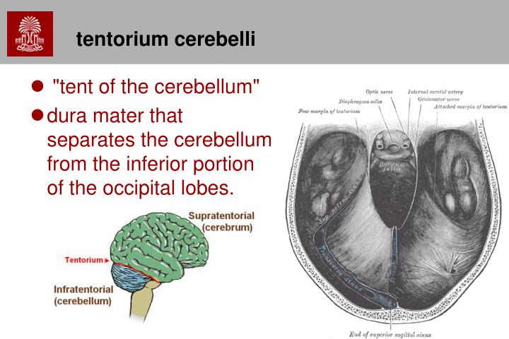 PPT - Chapters 12 Motor System – Cerebellum PowerPoint Presentation ...
