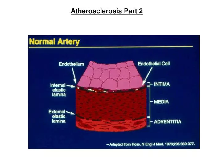 PPT - Atherosclerosis Part 2 PowerPoint Presentation, free download ...