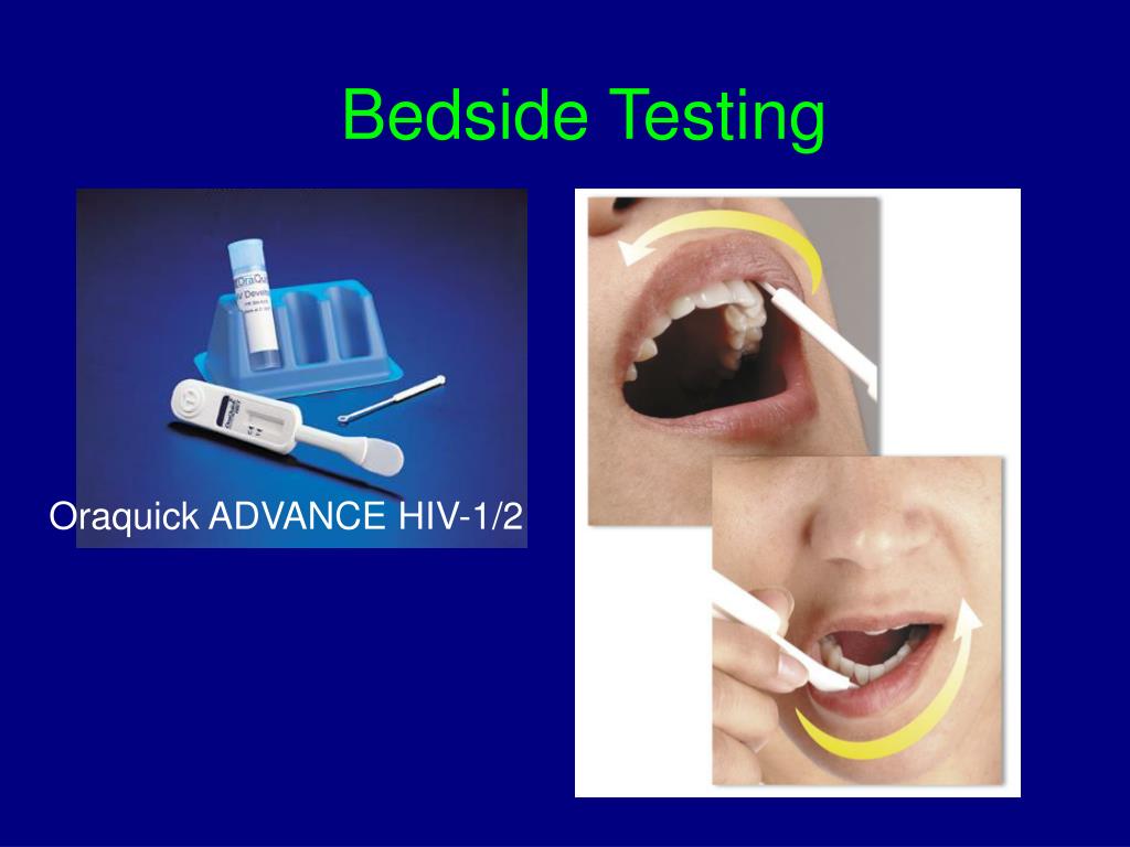 PPT - HIV Screening in an Urban Emergency Department The Highland ...