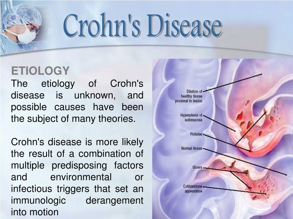 PPT - Dr David Swar Department of General Surgery (Resident) Stomach ...