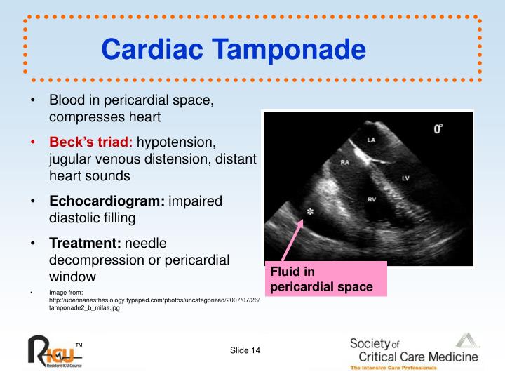 PPT - Program Information PowerPoint Presentation - ID:2968327