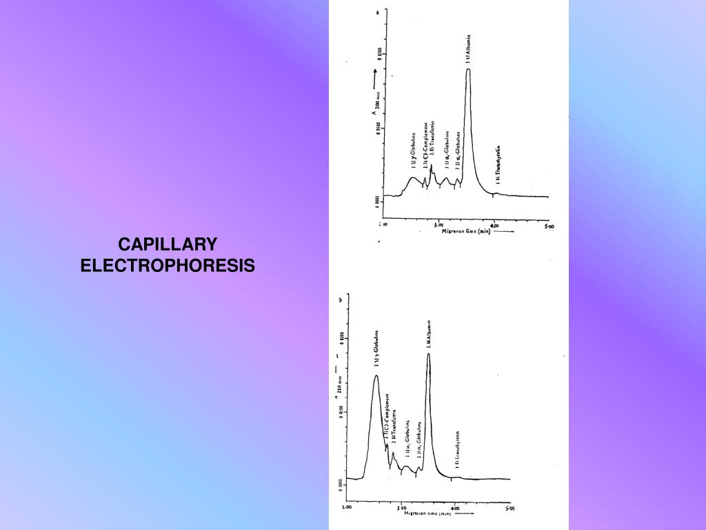 PPT - Protein Electrophoresis 1/1 Serum Protein Electrophoresis ...