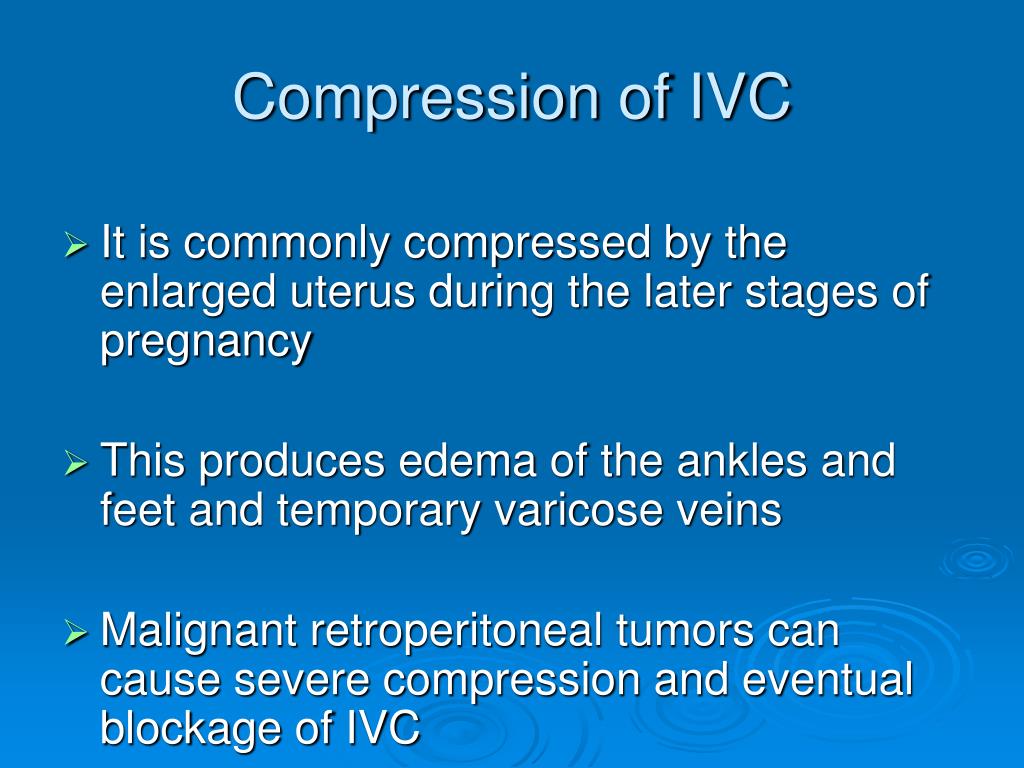 PPT - ABDOMINAL AORTA AND INFERIOR VENA CAVA PowerPoint Presentation ...