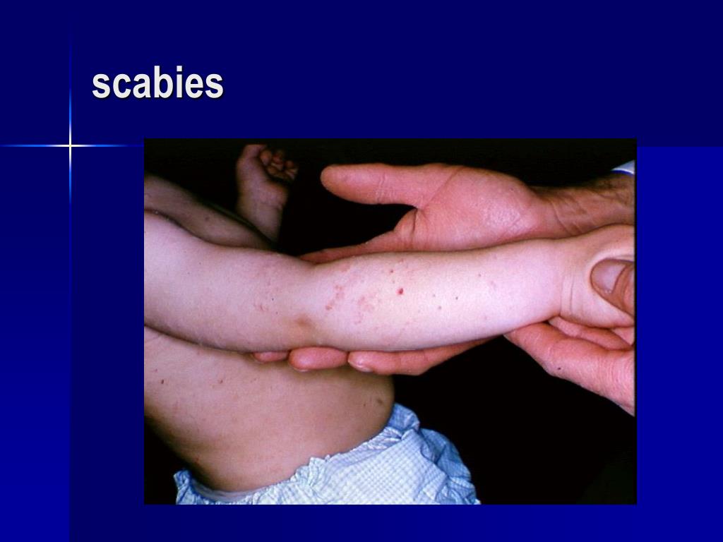 PPT - Medical Entomology PowerPoint Presentation, free download - ID ...