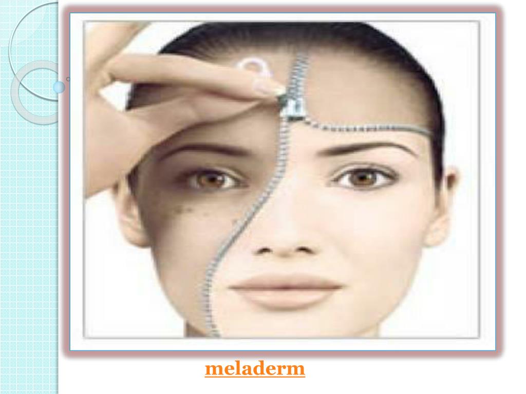 PPT - The Most Important Facts About Meladerm Cream PowerPoint ...