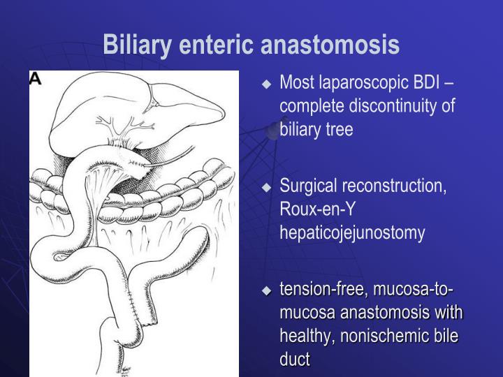 PPT - Bile Duct Injuries PowerPoint Presentation - ID:2969964