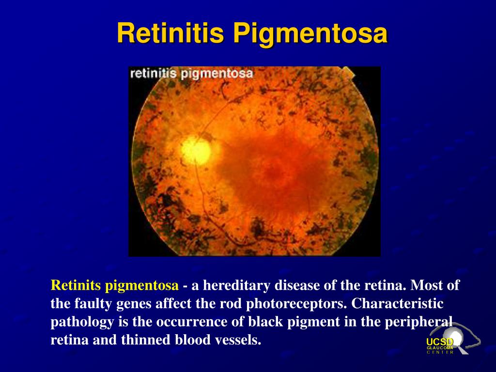 PPT - General Anatomy of the Eye & Degenerative Diseases of Human ...