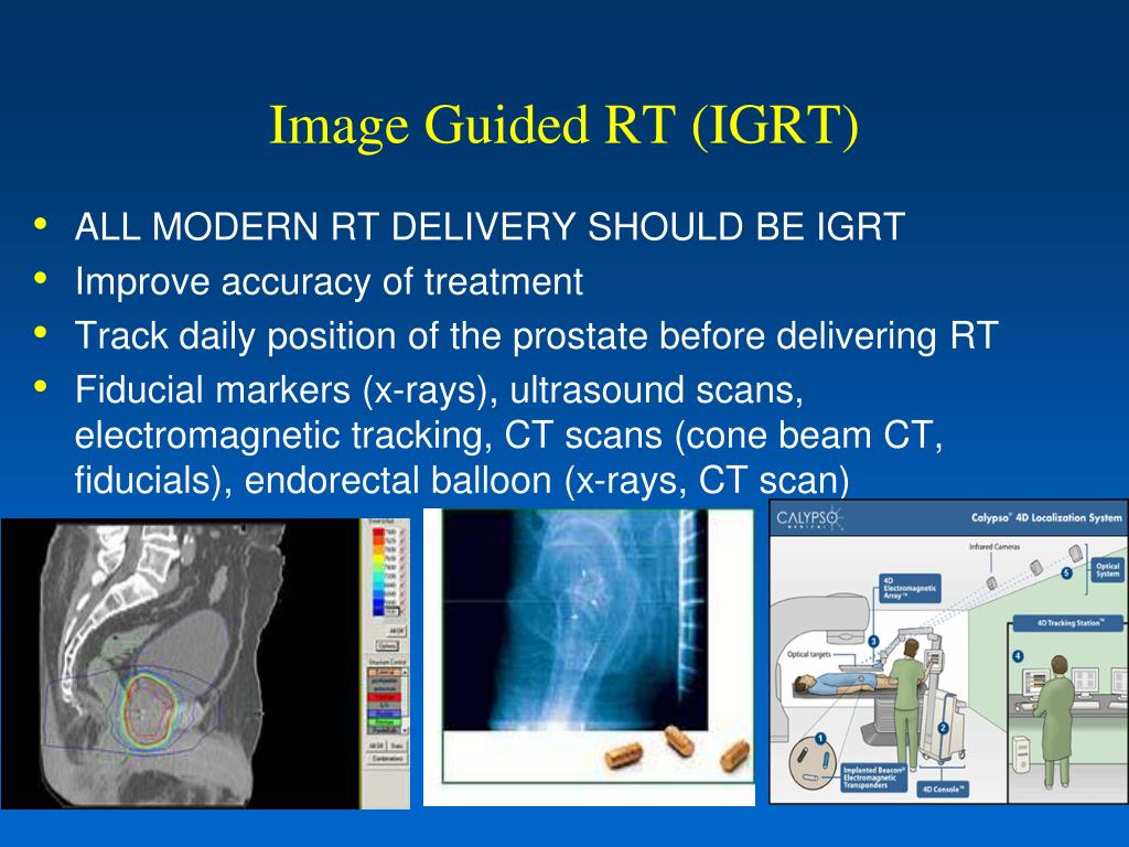PPT - Radiation therapy for Early Stage Prostate Cancer PowerPoint ...