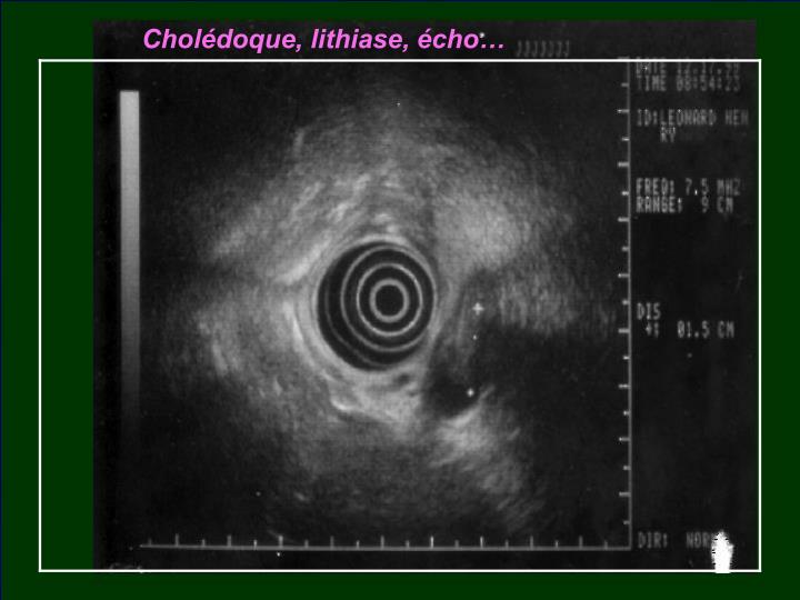 PPT - LITHIASE CHOLEDOCIENNE PowerPoint Presentation - ID:2971845