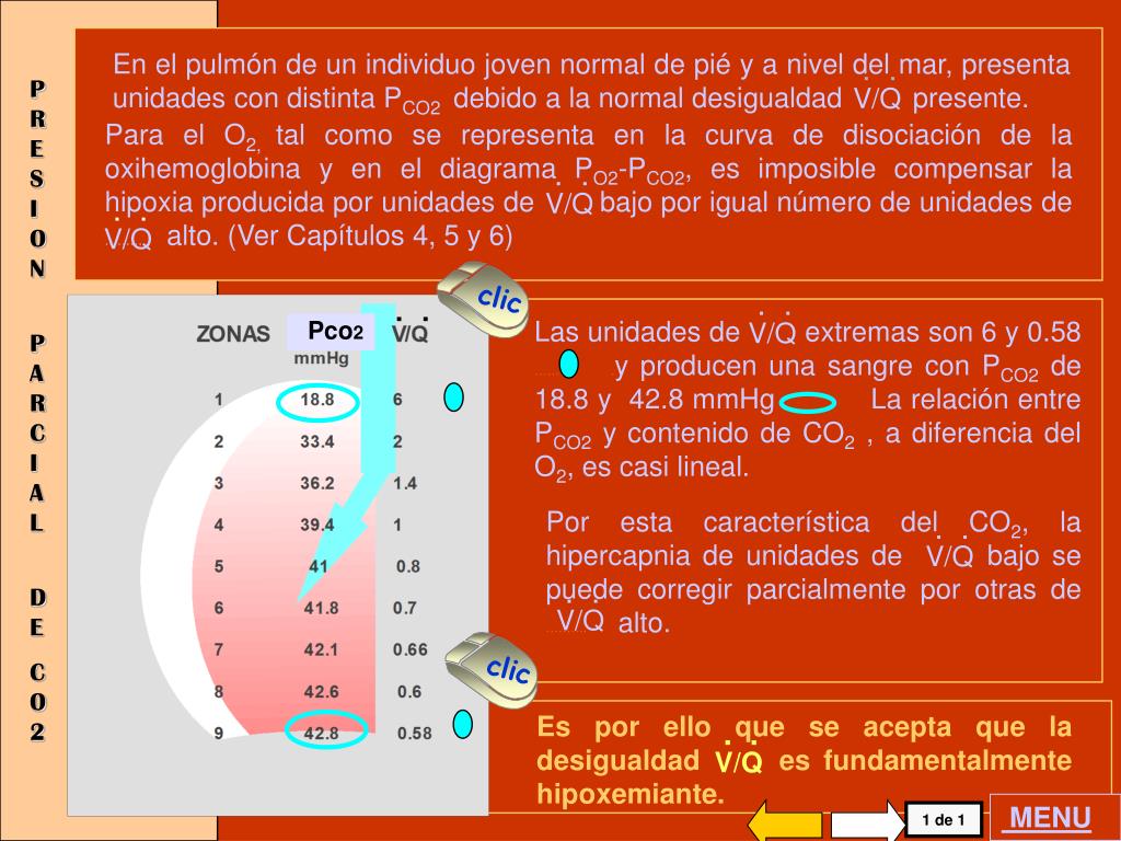 Ppt Distribucion Patologica De V Q Powerpoint Presentation Free