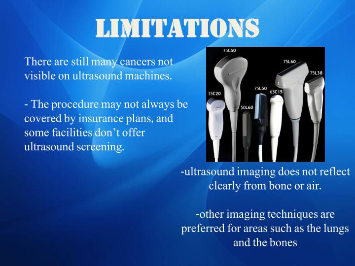 PPT - Ultrasound Machine PowerPoint Presentation - ID:2972129