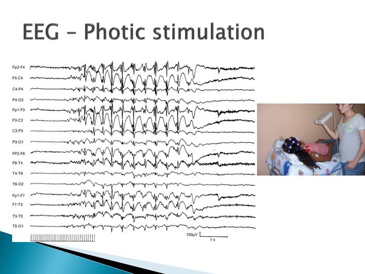 PPT - EEG brain for medical investigation and management PowerPoint ...