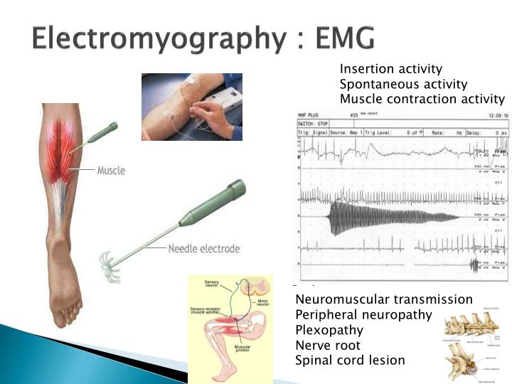 PPT - EEG brain for medical investigation and management PowerPoint ...