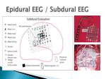 PPT - EEG brain for medical investigation and management PowerPoint ...