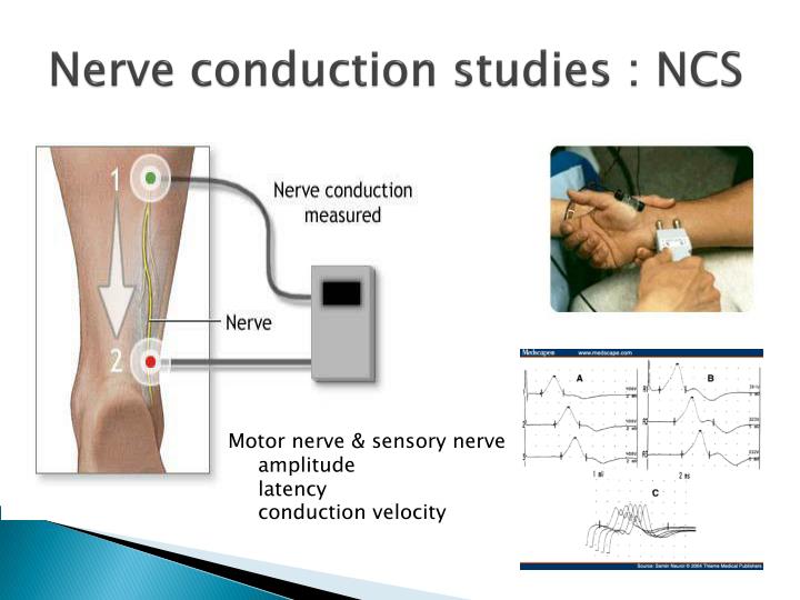 PPT - EEG brain for medical investigation and management PowerPoint ...