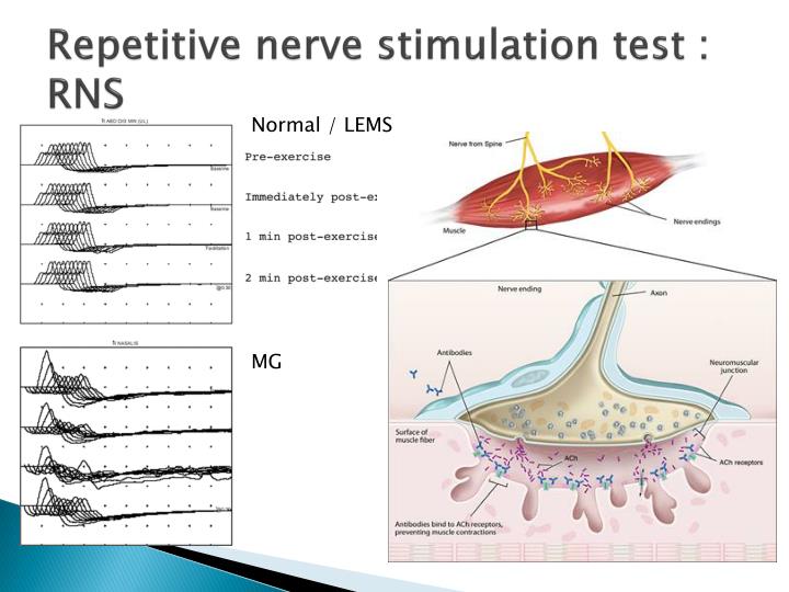 PPT - EEG brain for medical investigation and management PowerPoint ...