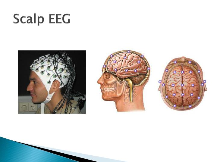 PPT - EEG brain for medical investigation and management PowerPoint ...