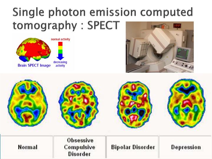 PPT - EEG brain for medical investigation and management PowerPoint ...
