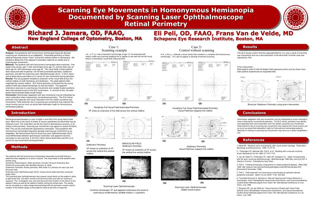 PPT - Richard J. Jamara, OD, FAAO, New England College of Optometry ...