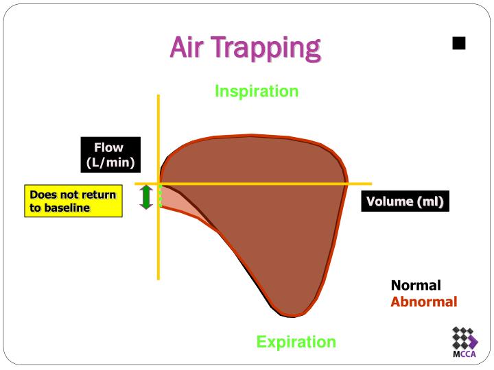 PPT - Advanced Pulmonary Mechanics during Mechanical Ventilation ...
