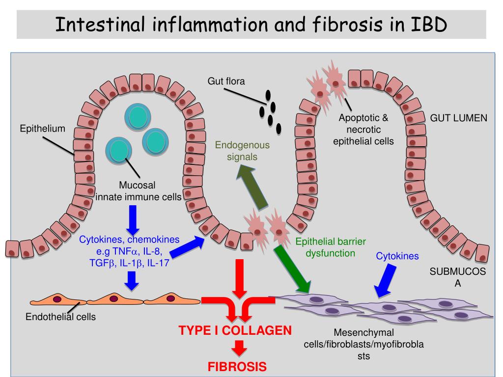 PPT - Epigenetic regulation of IBD-associated fibrosis: potential for ...