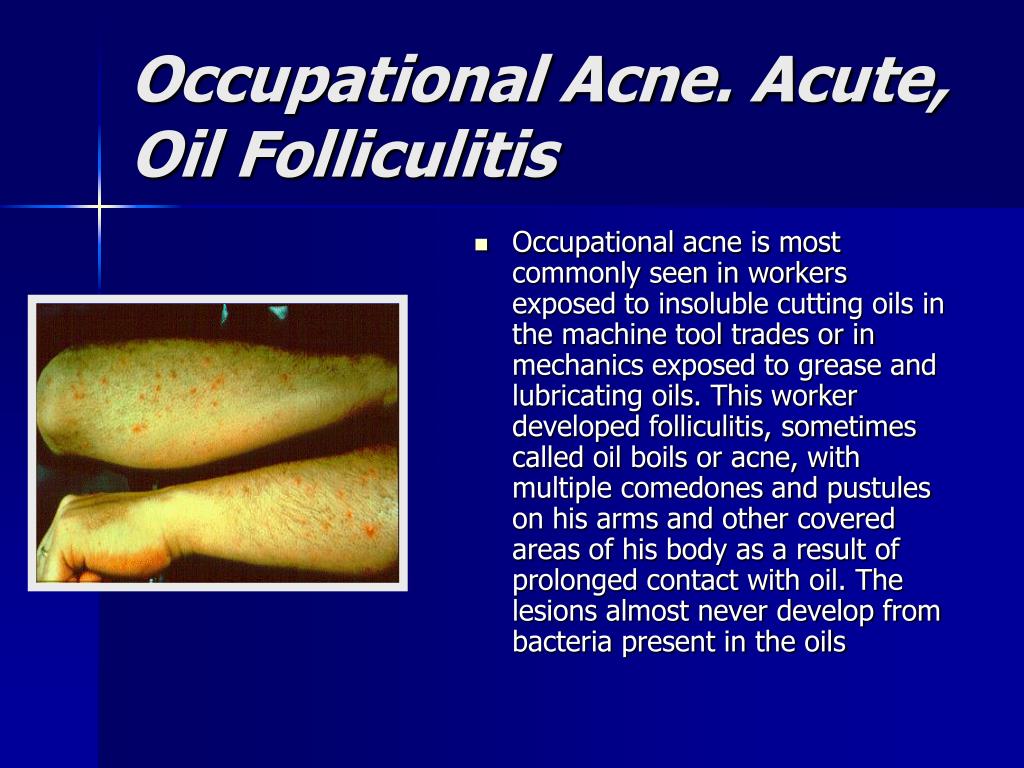 Ppt Dermatosis Akibat Kerja Powerpoint Presentation Free Download