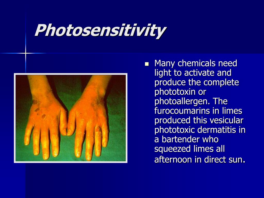 PPT - DERMATOSIS AKIBAT KERJA PowerPoint Presentation, free download ...