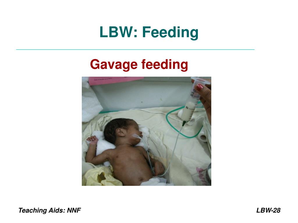 PPT - Management of Low Birth Weight Babies PowerPoint Presentation ...