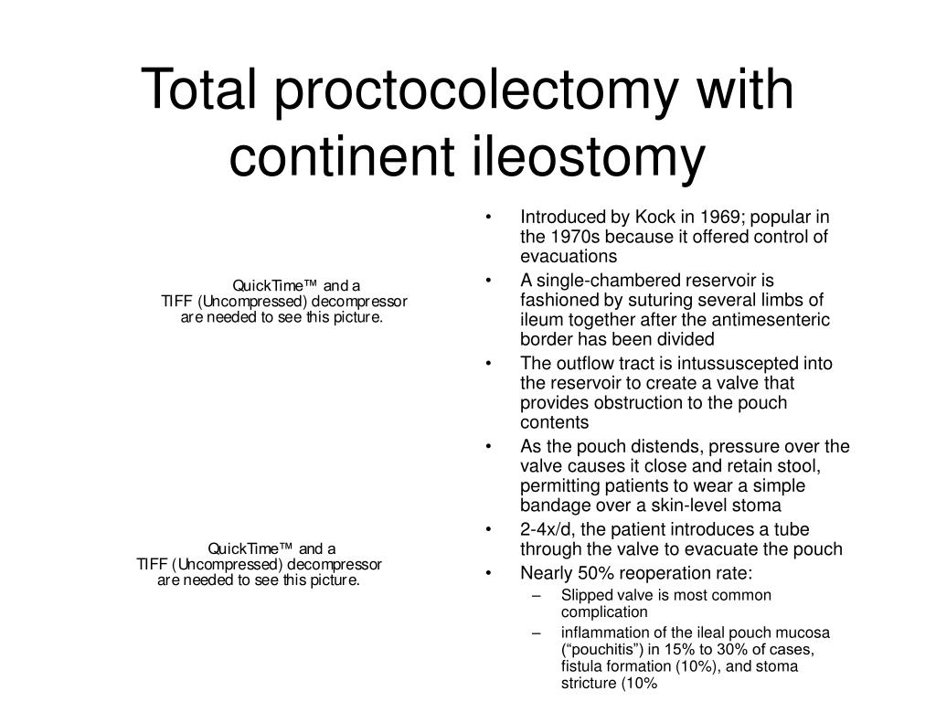 PPT - Inflammatory Bowel Disease Ulcerative Colitis, Crohn’s PowerPoint ...