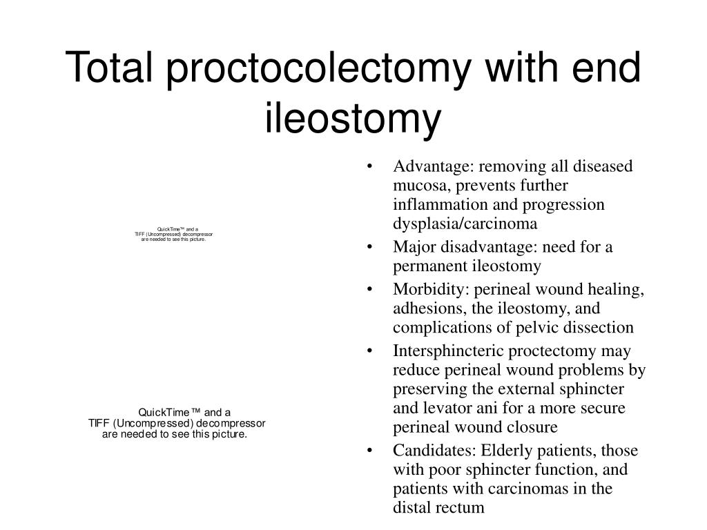 PPT - Inflammatory Bowel Disease Ulcerative Colitis, Crohn’s PowerPoint ...