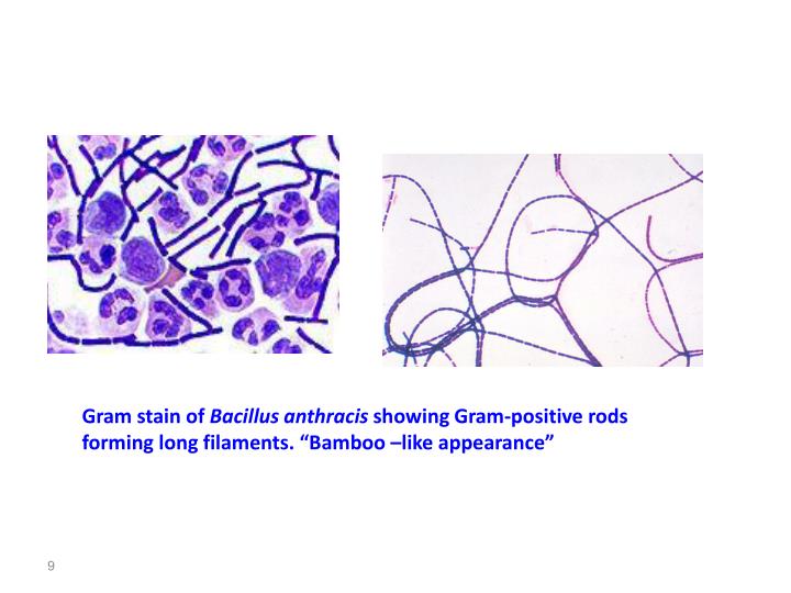 PPT - Diagnostic microbiology lecture: 11 Gram Positive, Endospore ...