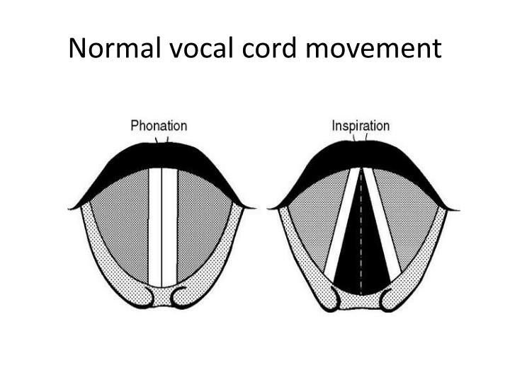 PPT - Applied Anatomy of Airway PowerPoint Presentation - ID:2976616