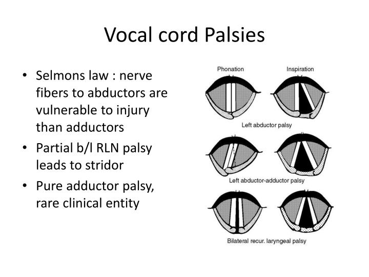 PPT - Applied Anatomy of Airway PowerPoint Presentation - ID:2976616