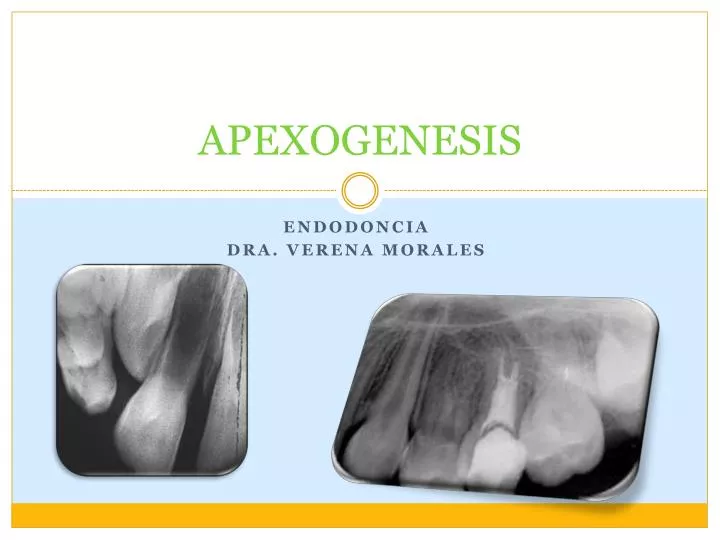 PPT - APEXOGENESIS PowerPoint Presentation, free download - ID:2976623