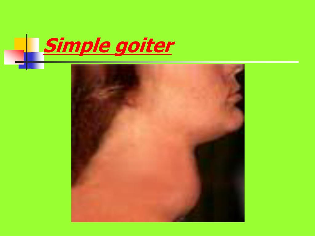 PPT - Thyroid hormones and antithyroid drugs PowerPoint Presentation ...