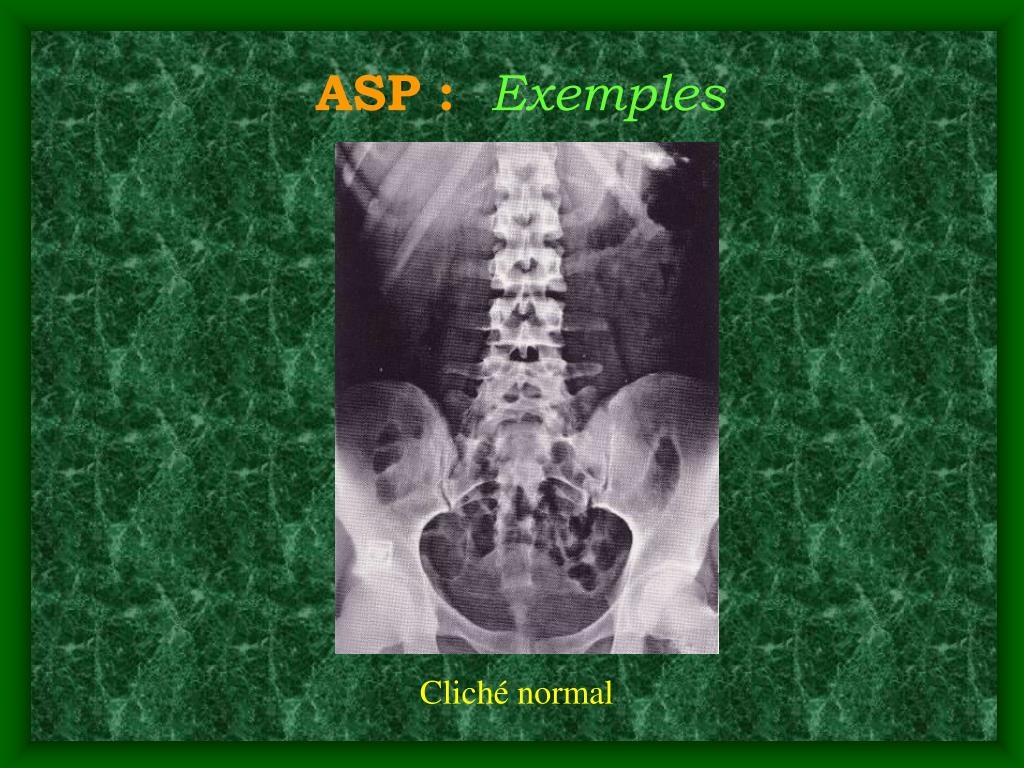 PPT - Séméïologie uro-néphrologique 2) Examens complémentaires ...