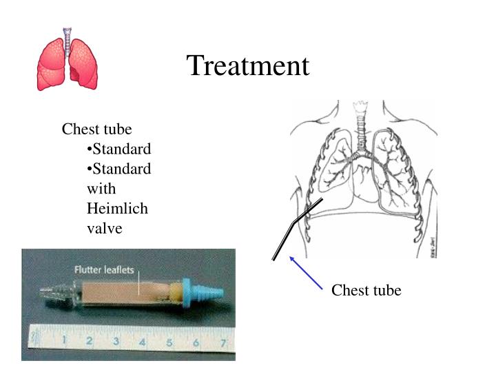 PPT - Penetrating Chest Wounds, Pneumothorax, Tension Pneumothorax and ...