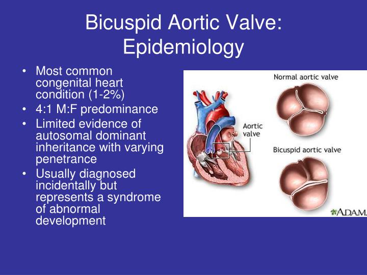 PPT - ADULT CONGENITAL HEART DISEASE- COMMON CONDITIONS PowerPoint ...