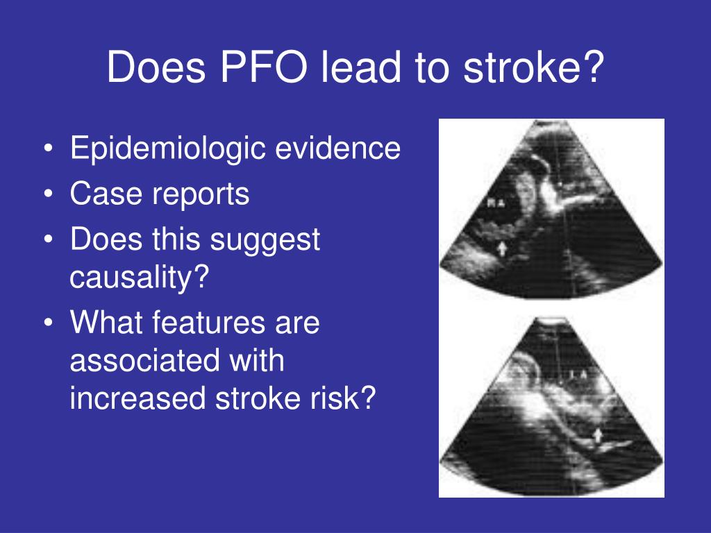 PPT - ADULT CONGENITAL HEART DISEASE- COMMON CONDITIONS PowerPoint ...