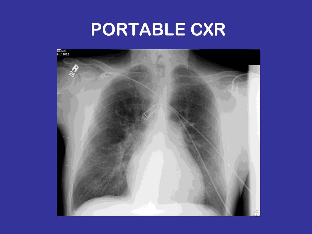 PPT - ADULT CONGENITAL HEART DISEASE- COMMON CONDITIONS PowerPoint ...