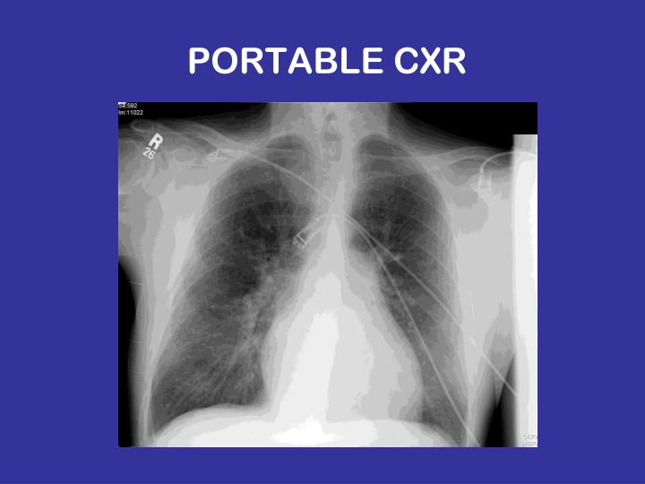 PPT - ADULT CONGENITAL HEART DISEASE- COMMON CONDITIONS PowerPoint ...
