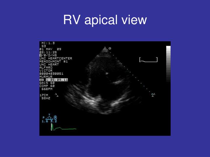 PPT - ADULT CONGENITAL HEART DISEASE- COMMON CONDITIONS PowerPoint ...