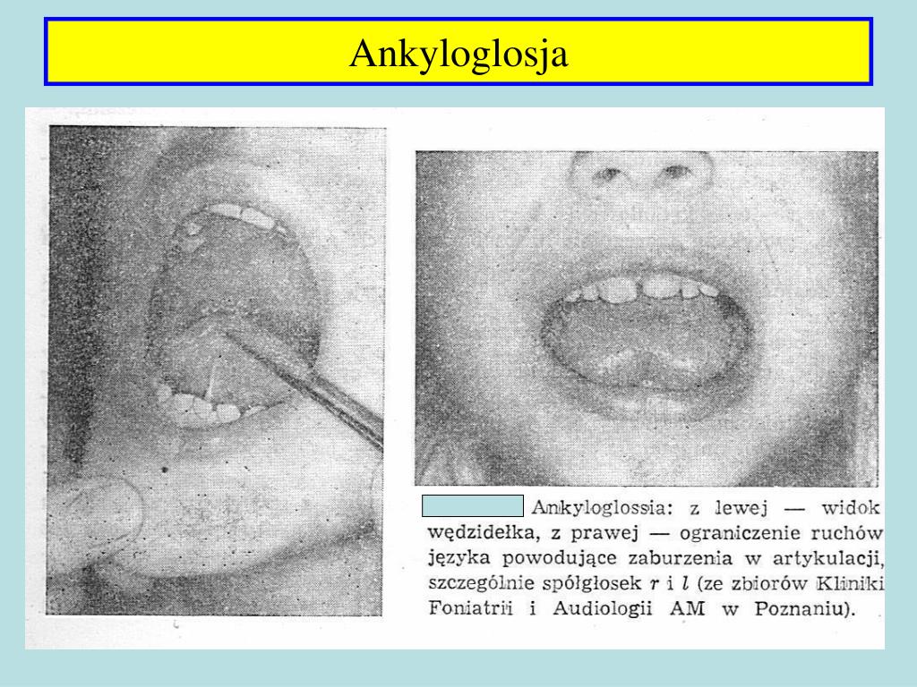 PPT - Anatomiczno-fizjologiczne przyczyny opóźnień /zaburzeń rozwoju ...