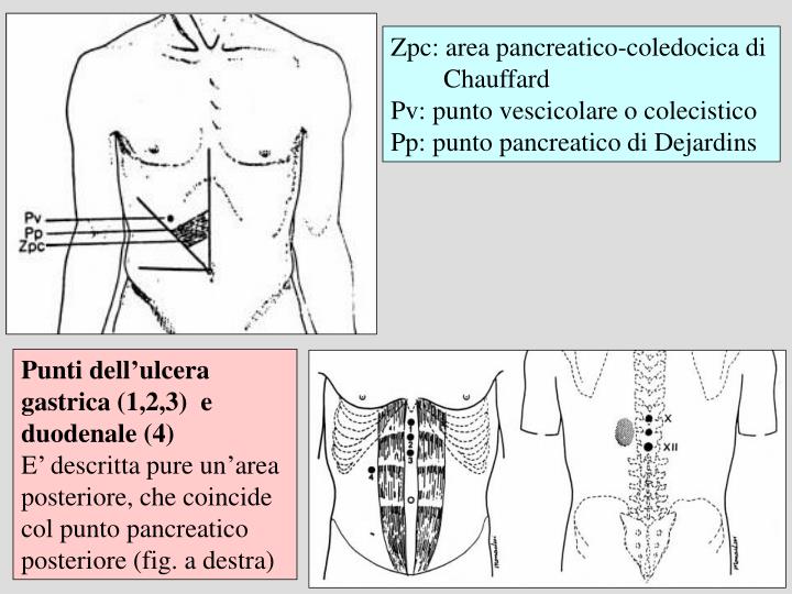 PPT - 3. Dolorabilità e reazione a manovre semeiologiche (punti ...