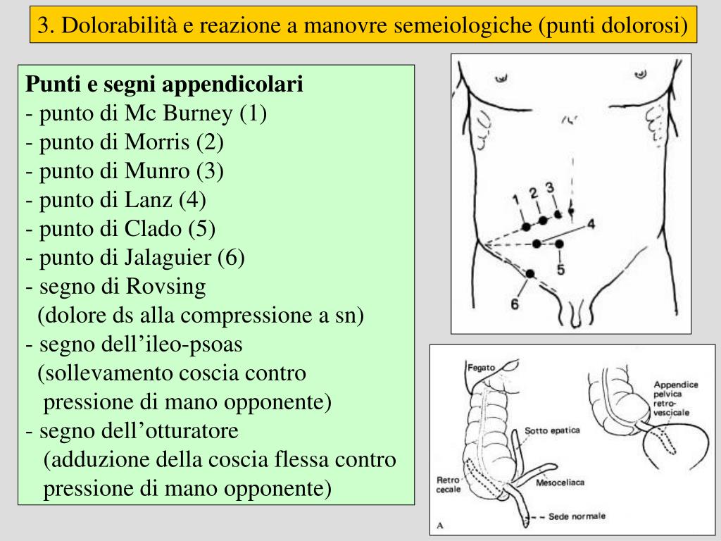 PPT - 3. Dolorabilità e reazione a manovre semeiologiche (punti ...