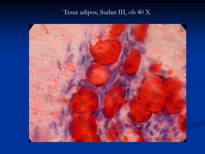 PPT - VARIETATI DE Ţ ESUT CONJUNCTIV PowerPoint Presentation - ID:2981082