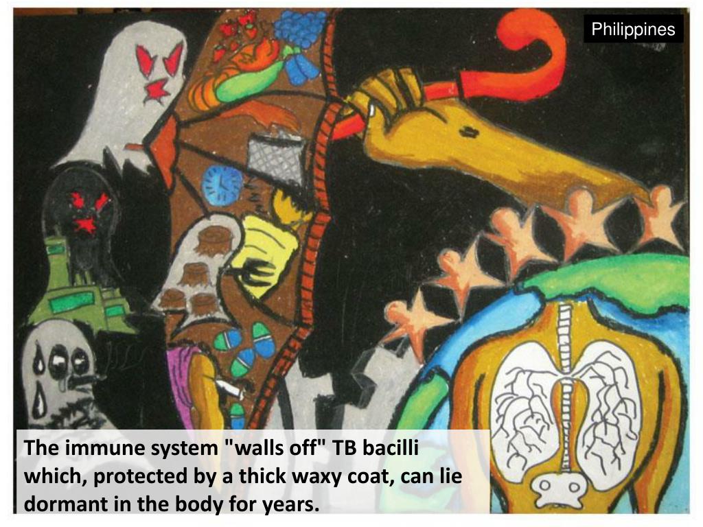 PPT - Tuberculosis quick facts Illustrated through drawings from ...