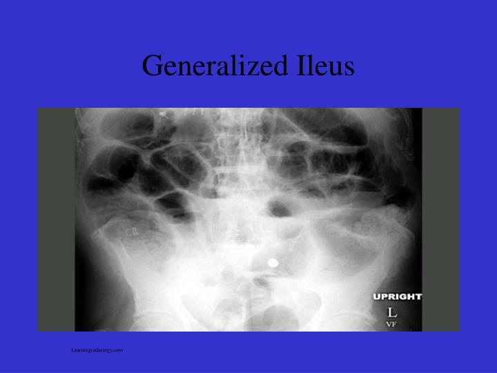PPT - Abdominal X-Ray PowerPoint Presentation - ID:2983195