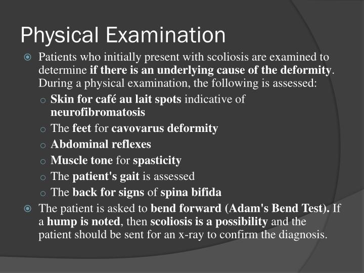 PPT - SCOLIOSIS PowerPoint Presentation - ID:2983653