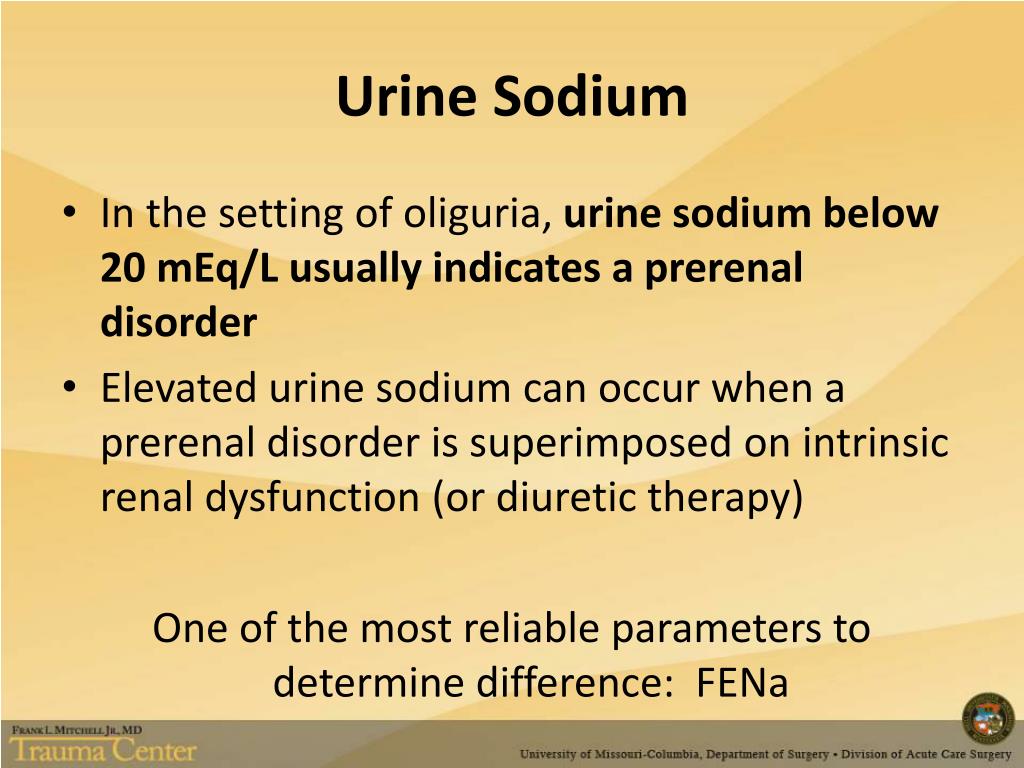 PPT - Acute Kidney Injury PowerPoint Presentation, free download - ID ...
